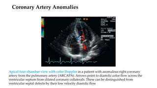 Echocardiography in intervention cardiology | PPTX