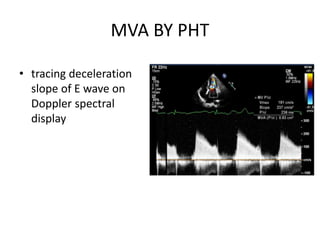 Echocardiography in mitral stenosis | PPTX