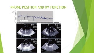 Echocardiography in res failure | PPT
