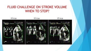 Echocardiography in shock | PPTX