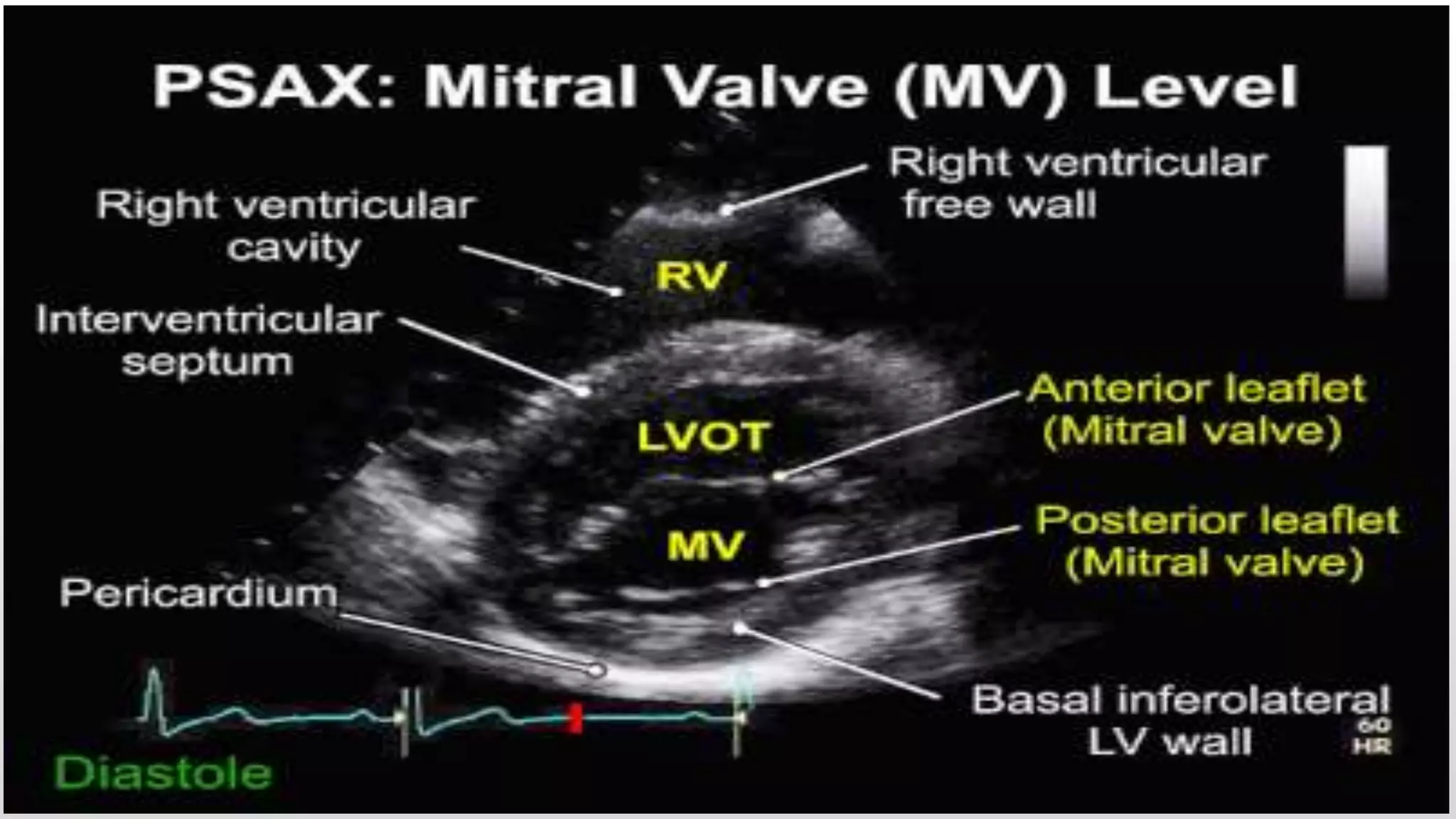 Echocardiography | PPTX
