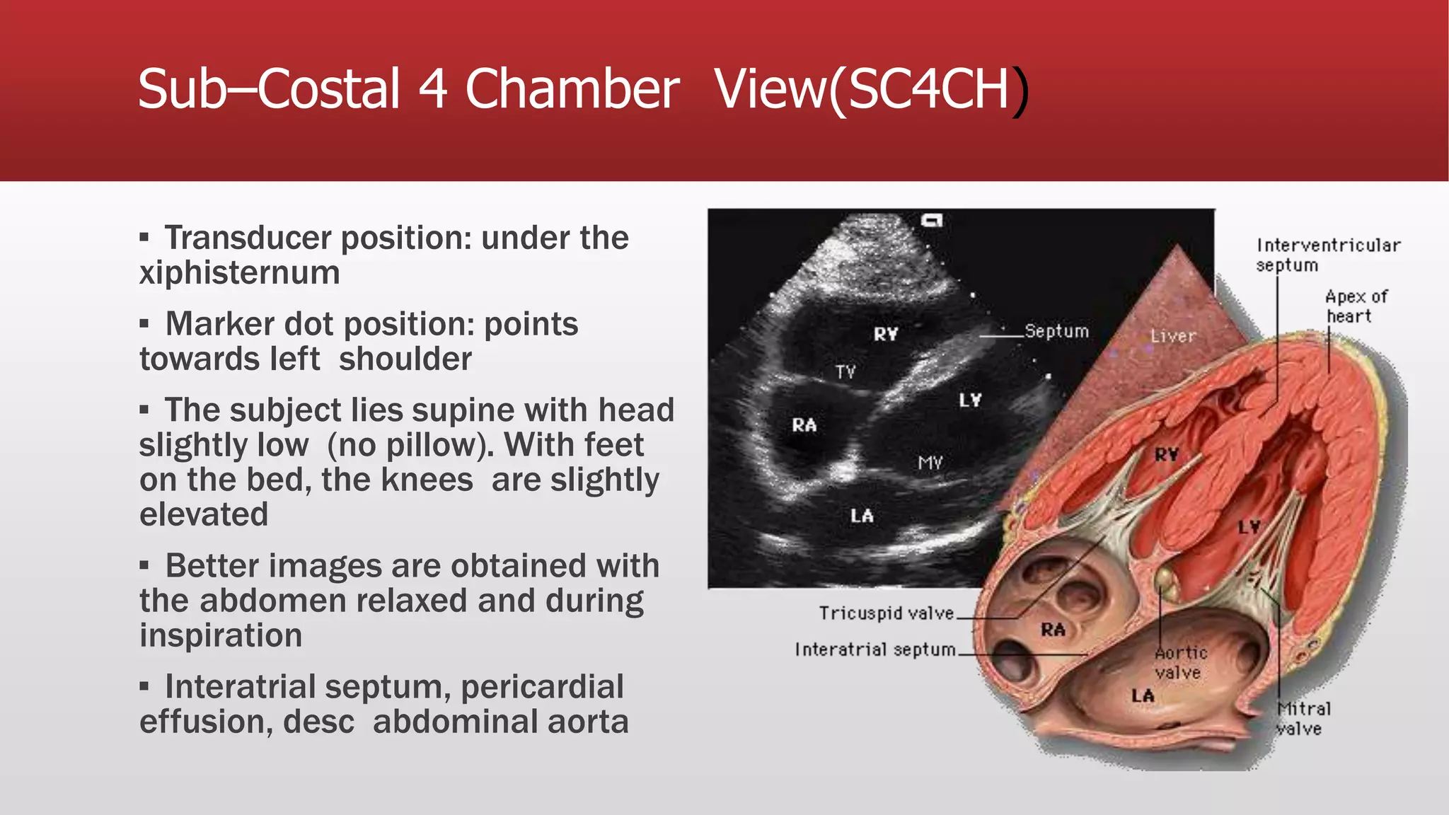 Echocardiography | PPTX