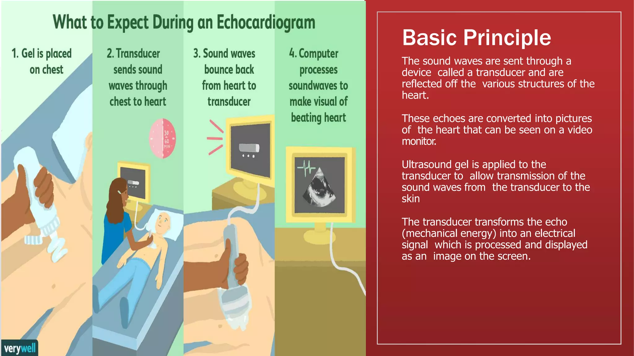 Echocardiography | PPTX