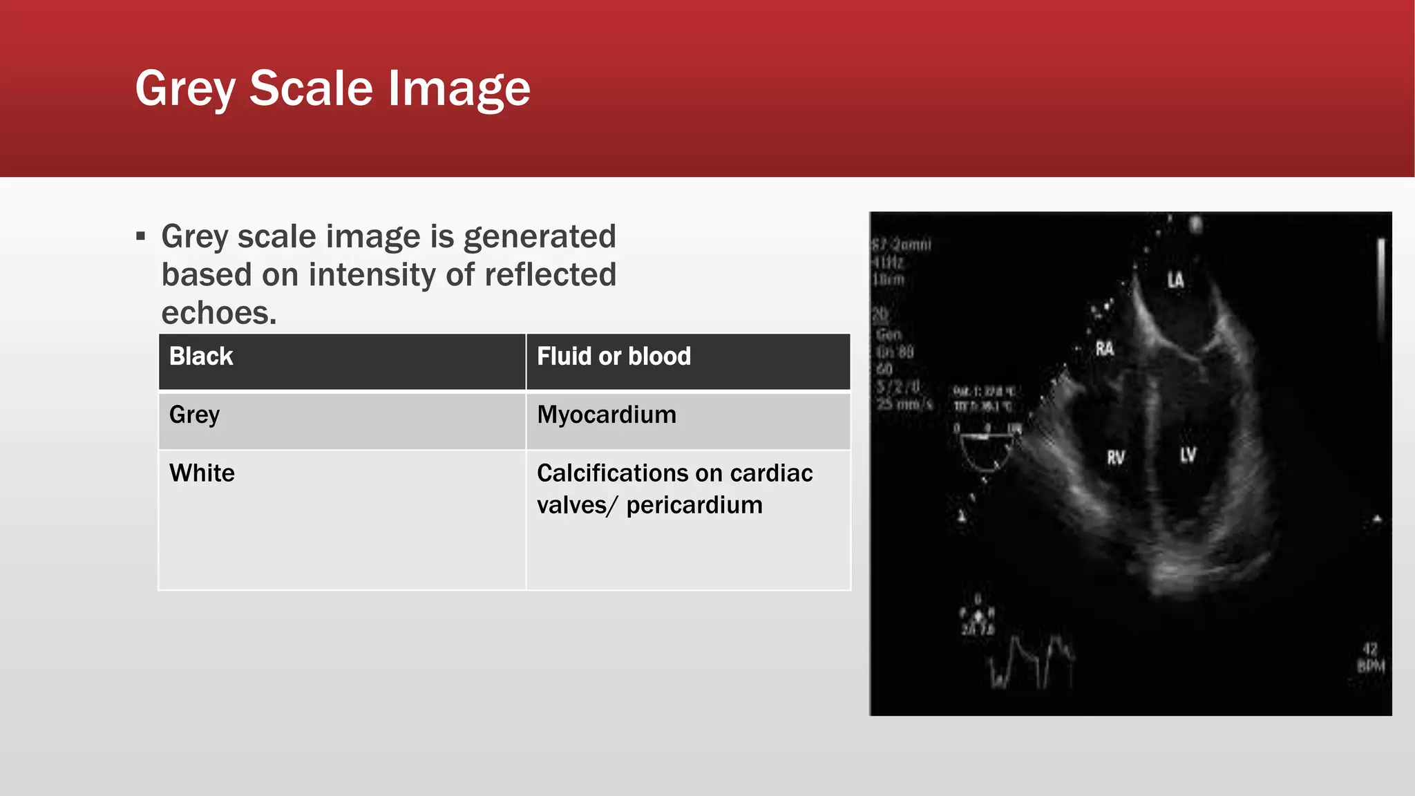 Echocardiography | PPTX