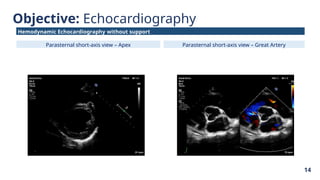 Echocardiography at CVCU of a patient.pptx