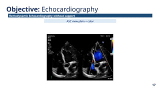 Echocardiography at CVCU of a patient.pptx