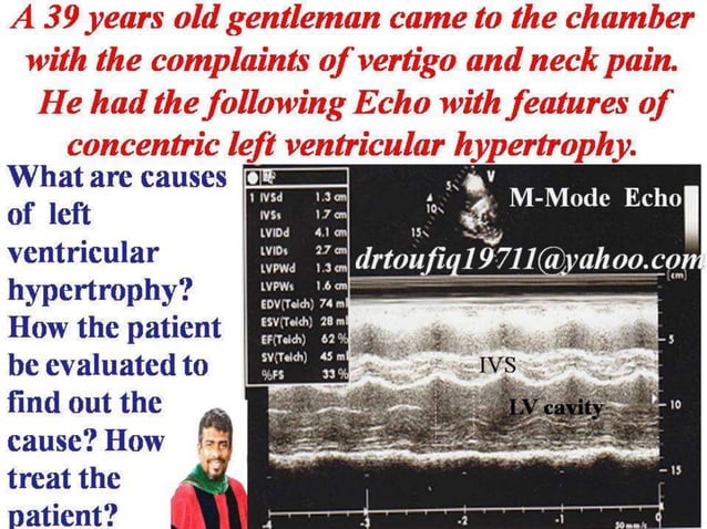 Echo evaluation 1 | PPT