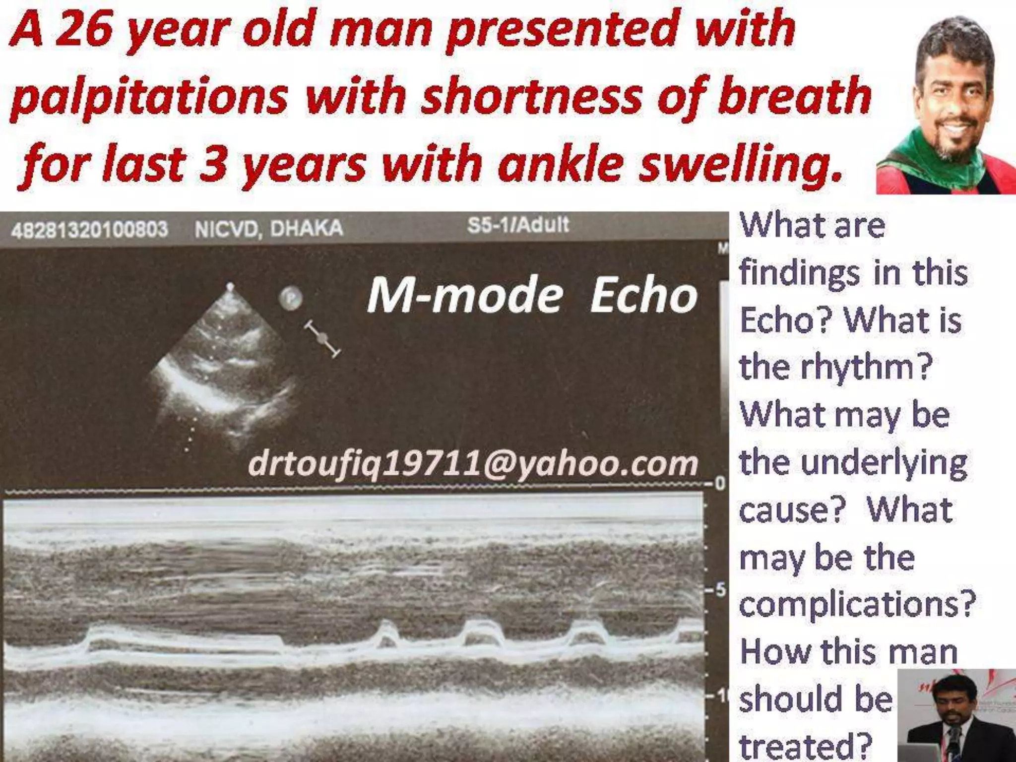 Echo evaluation 3 | PPSX