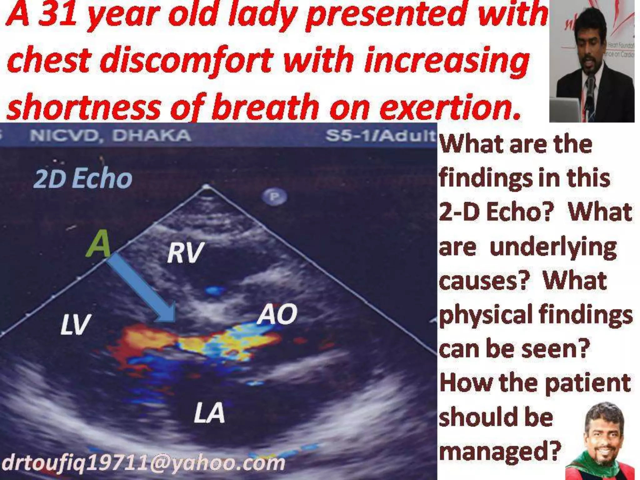 Echo evaluation 3 | PPSX