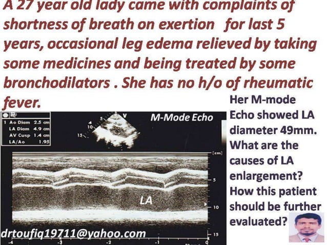 Echo evaluation 4 | PPSX