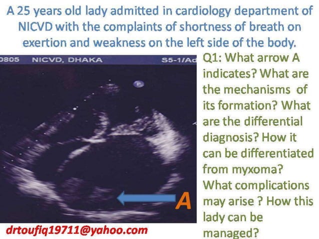 Echo evaluation 4 | PPSX