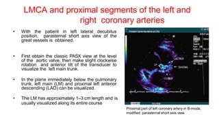 echo evaluation of coronary arteries.pptx