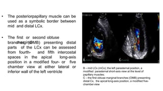 echo evaluation of coronary arteries.pptx