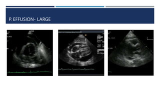Echo for Chest pain for IM anmd ER resident.pptx