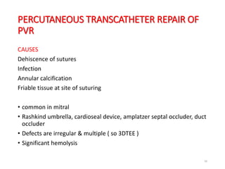 Echo for transcatheter valve therapies - Copy.pptx