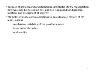Echo for transcatheter valve therapies - Copy.pptx