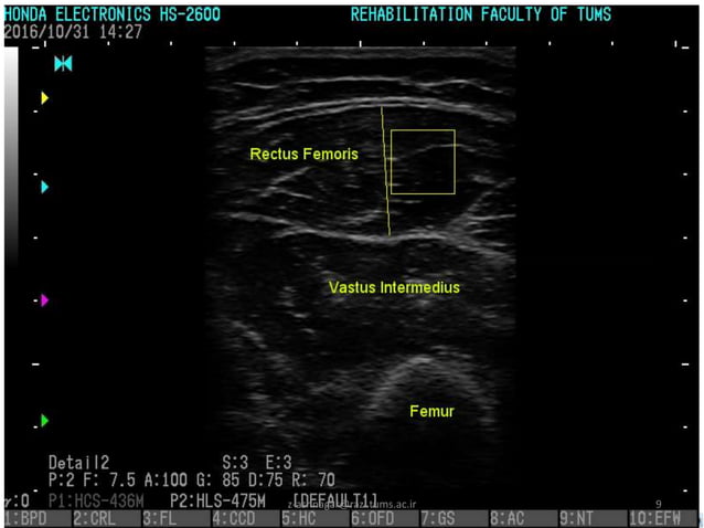 Echogenicity: Implication of Rehabilitative Ultrasound Imaging for ...