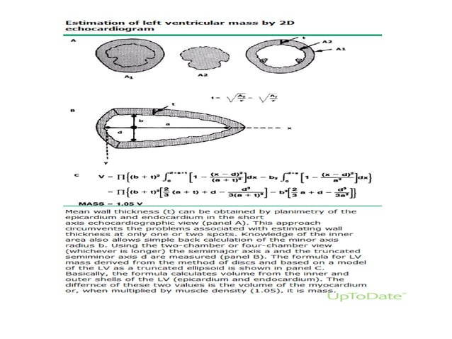 Echo in hypertrophic obstructive cardiomyopathies | PPTX