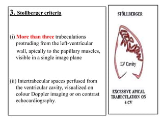 rare case of cardioembolic stroke in a child | PPT