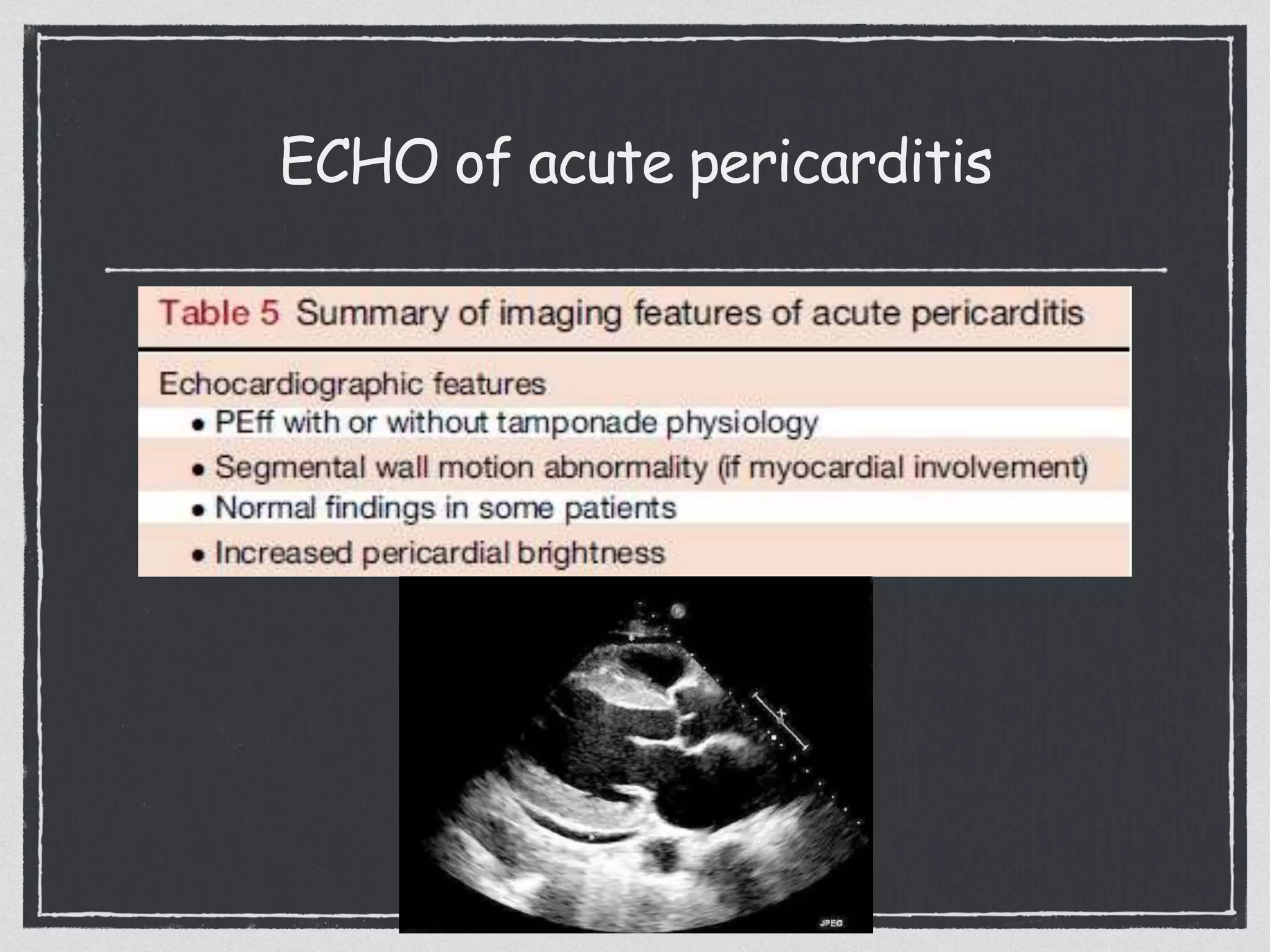 Echo in pericardial diseases | PPTX
