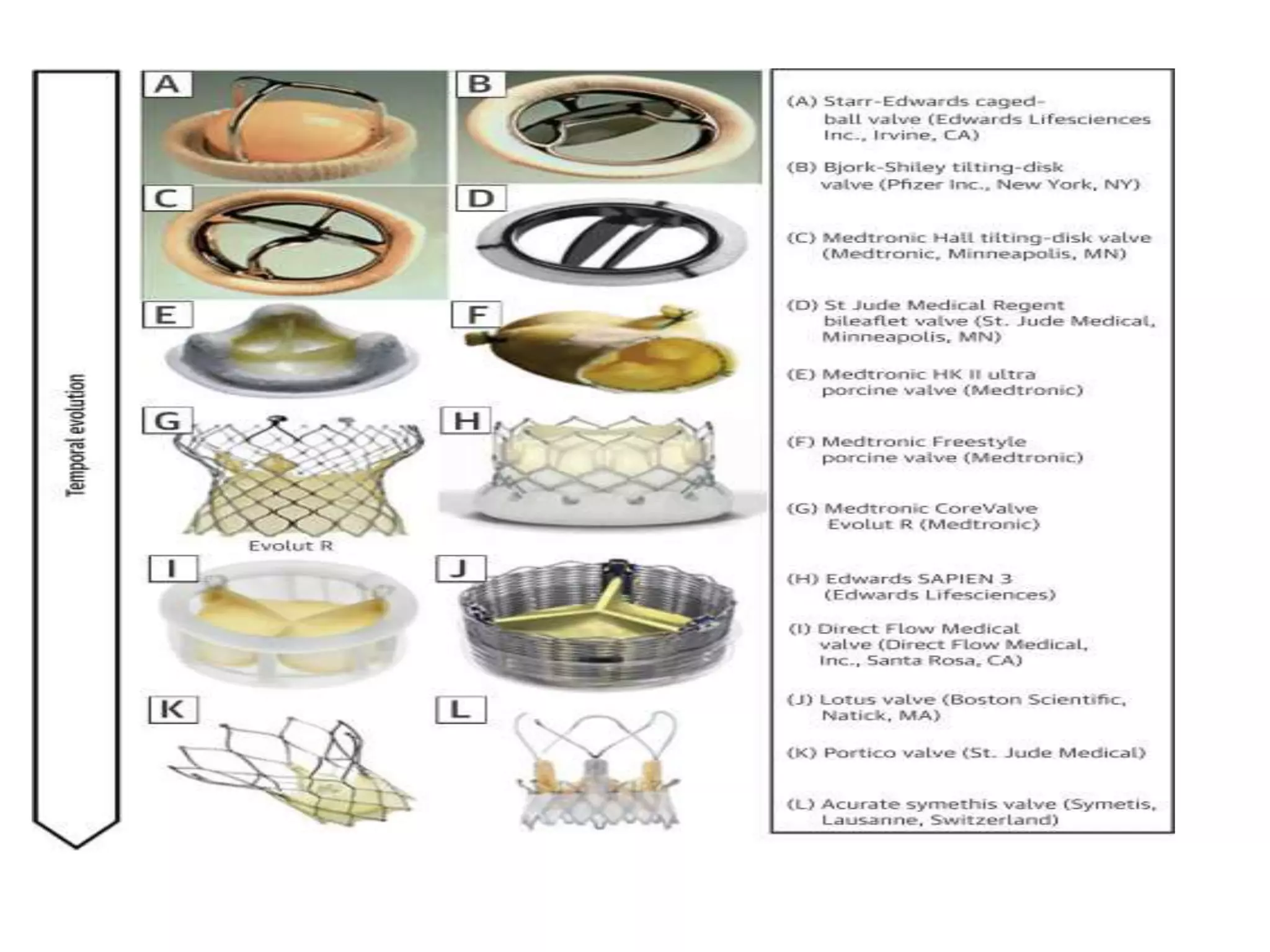 Echo in prosthetic valve evaluation | PPTX