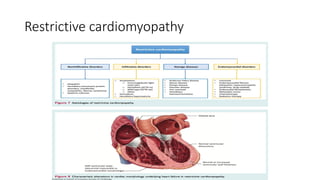 Echo in restrictive cardiomyopathy | PDF