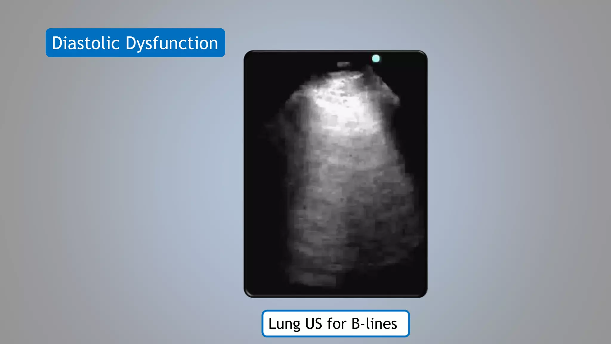 Echocardiographic Evaluation of Shock States | PPTX