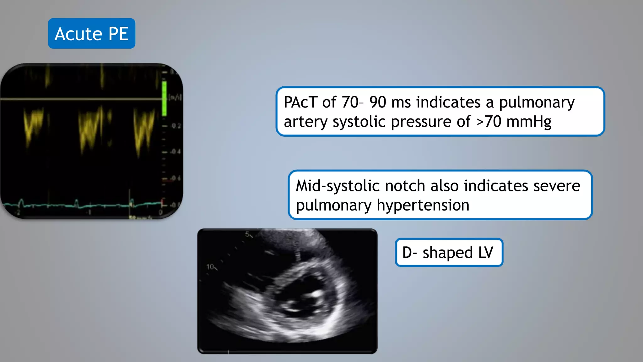 Echocardiographic Evaluation of Shock States | PPTX