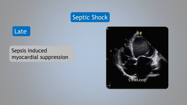 Echocardiographic Evaluation of Shock States | PPTX | Heart and ...