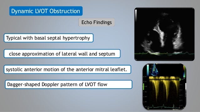 Echocardiographic Evaluation of Shock States