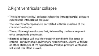 ECHOCARDIOGRAPHY IN CARDIAC TAMPONADE | PPTX