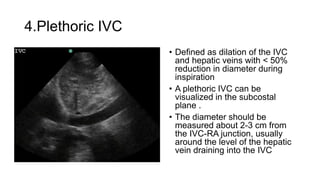 ECHOCARDIOGRAPHY IN CARDIAC TAMPONADE | PPTX