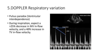 ECHOCARDIOGRAPHY IN CARDIAC TAMPONADE | PPTX