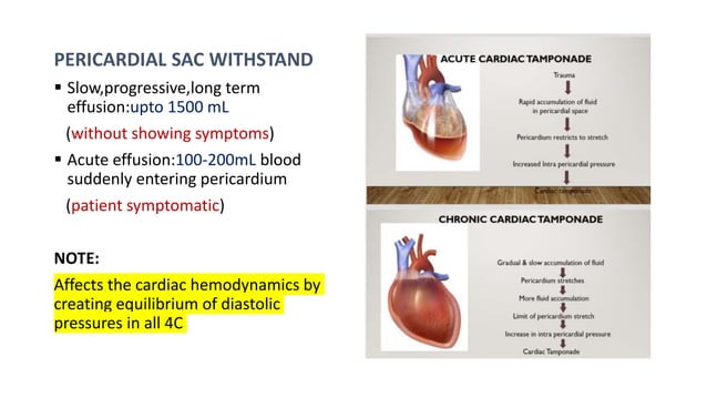 ECHOCARDIOGRAPHY IN CARDIAC TAMPONADE | PPTX