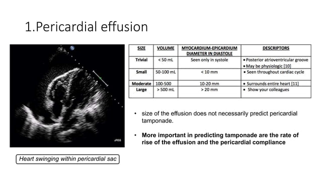 ECHOCARDIOGRAPHY IN CARDIAC TAMPONADE