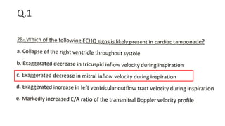 Echocardiography Multiple choice questions | PPTX