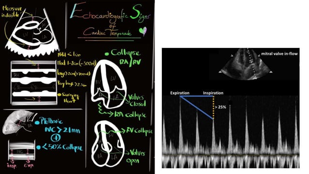 Echocardiography Multiple choice questions | PPTX