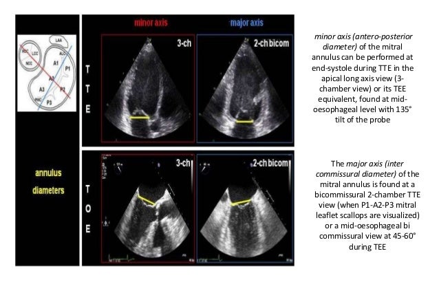 Difference Between Lv And Lvmhf | Paul Smith