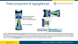Echo Mitral regurgitasi.pptx