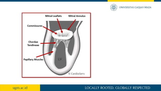 Echo Mitral regurgitasi.pptx