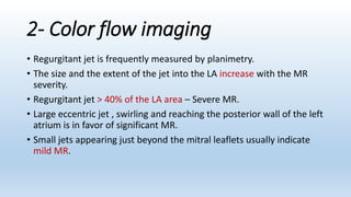 Echo Mitral Regurgitation-1.pptx