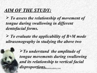 Echomyography of tongue | PPT