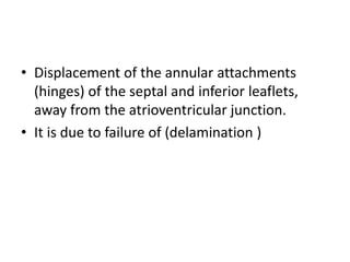 Echo of ebstein | PPT