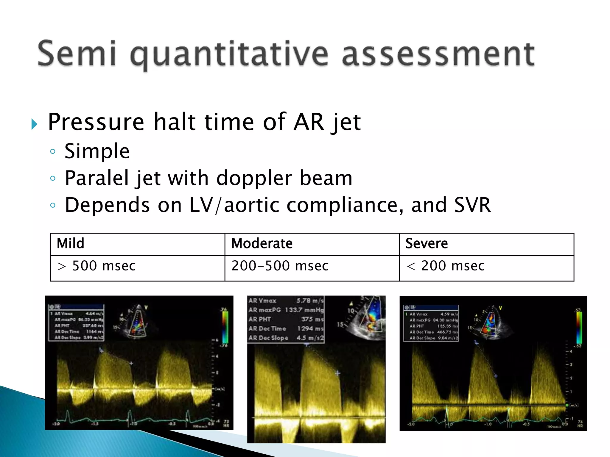 echo pada penyakit jantung katup final.pptx