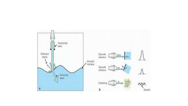Echo physics and instrumentation | PPTX