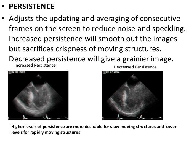 Echo physics and instrumentation