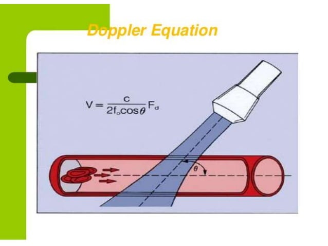 Echo Physics and Doppler | PPT