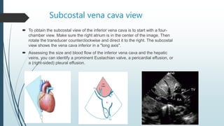 echocardiograhy window and views at large | PDF
