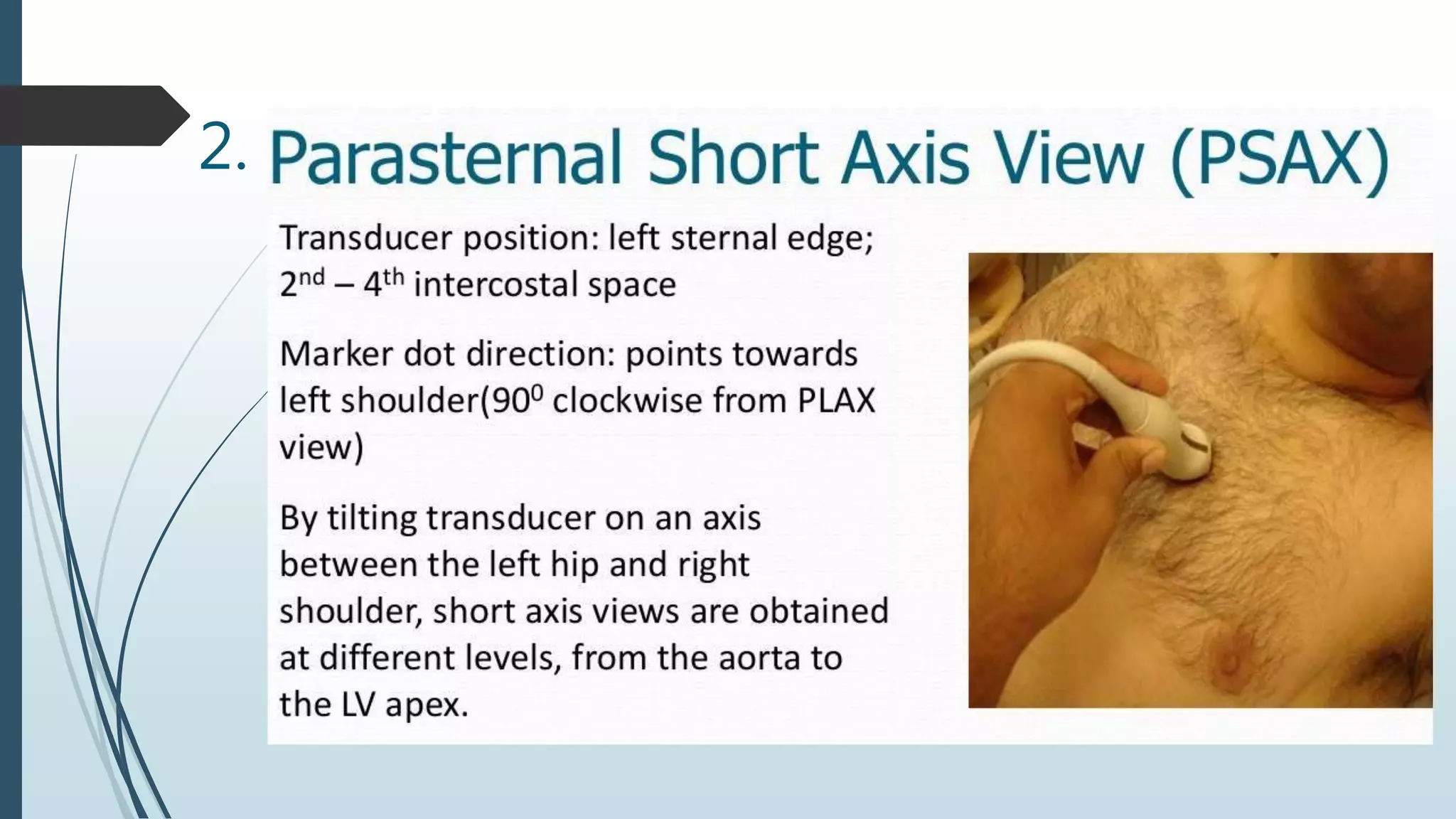 ECHO WINDOWS AND VIEWS.pptx