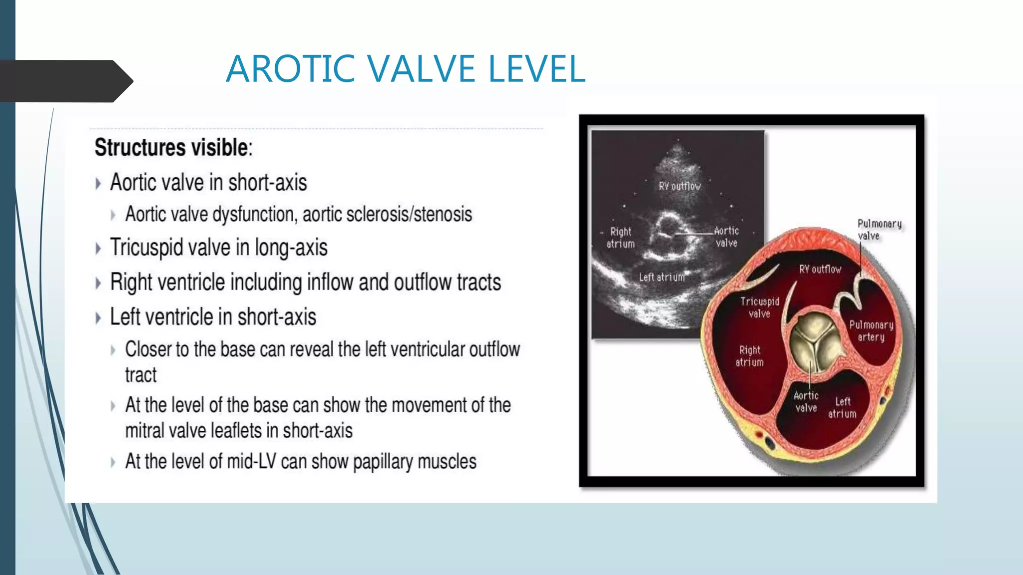 ECHO WINDOWS AND VIEWS.pptx